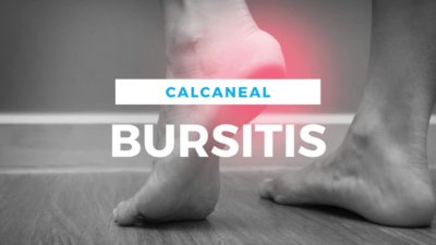 Top-Rated Bursitis Treatment Options - Richmond, VA