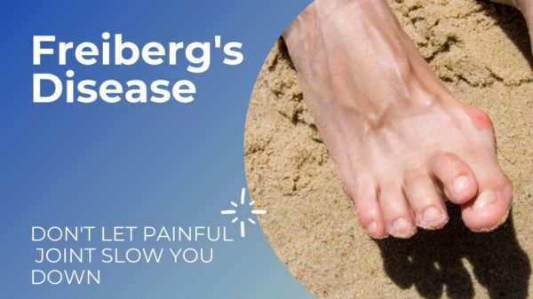 Freiberg's Disease Treatment for Kids - Pediatric Podiatrist