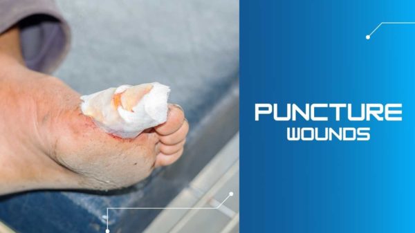 Richmond's #1 Puncture Wound Treatment | Achilles Foot & Ankle